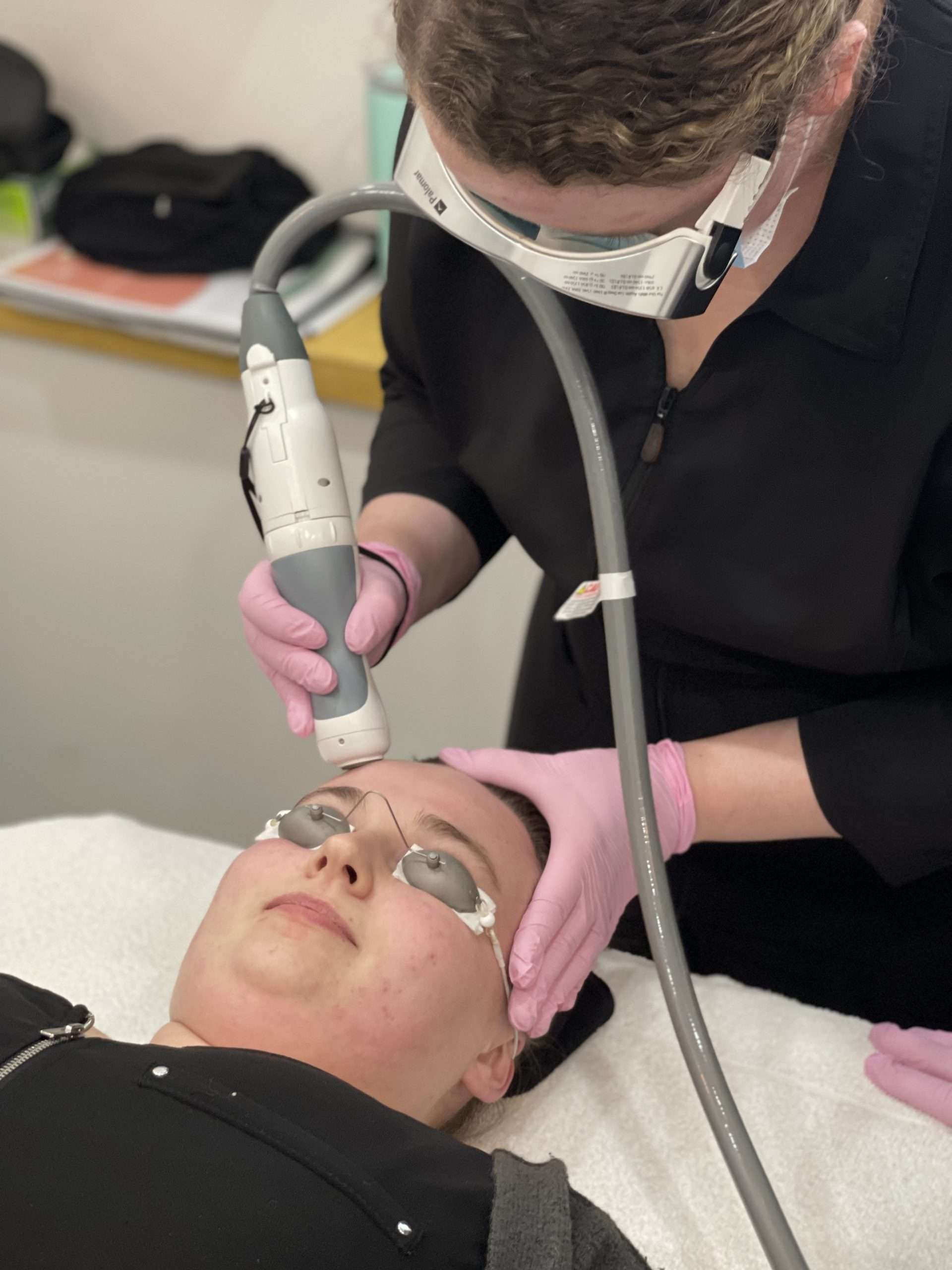 Melasma and Laser Treatments: What You Should Know