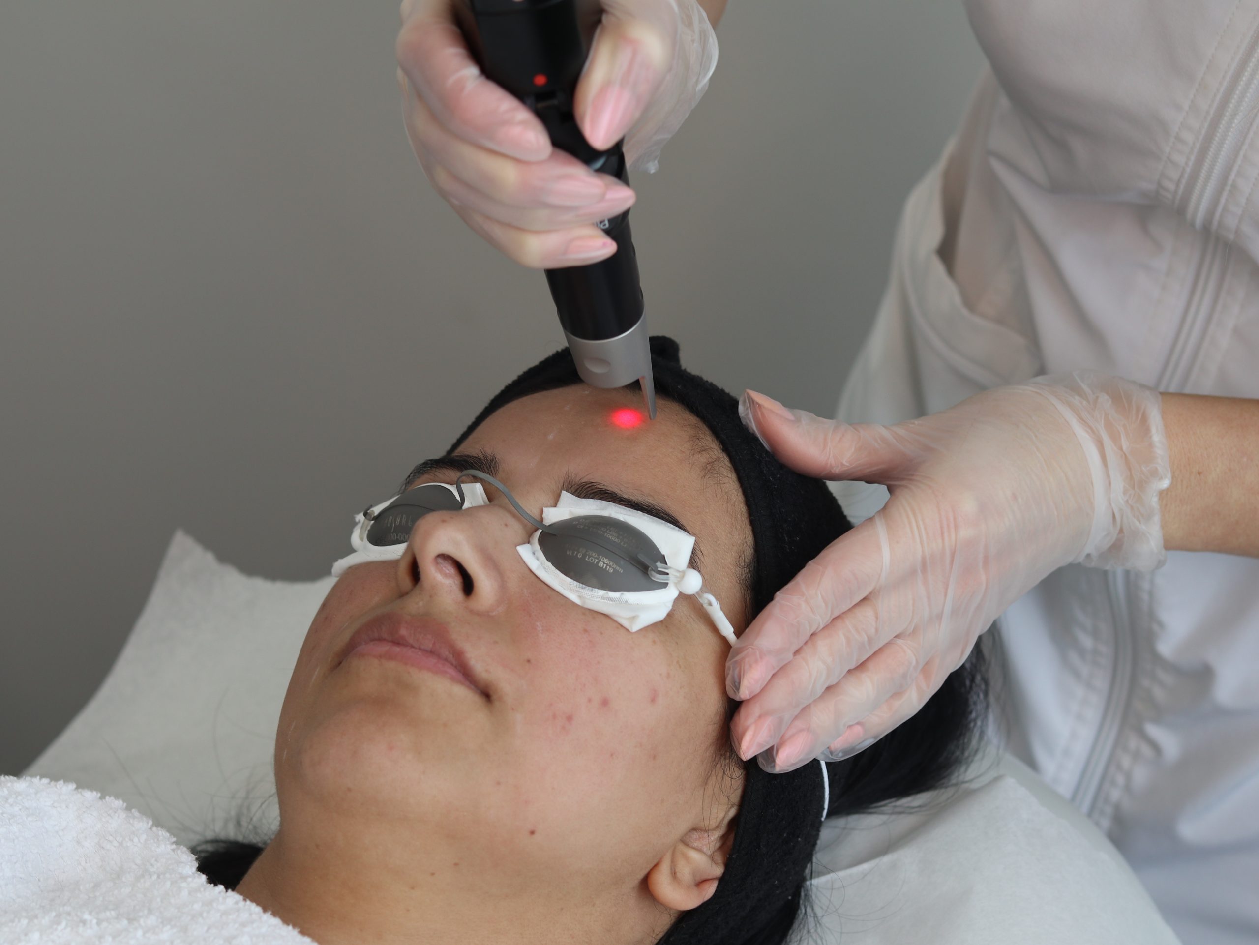 Laser Skin Resurfacing – Blog – Total Wrapture Medi Spa
