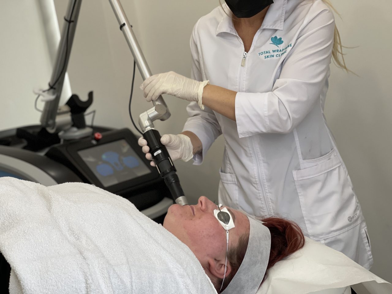 Melasma and Laser Treatments: What You Should Know