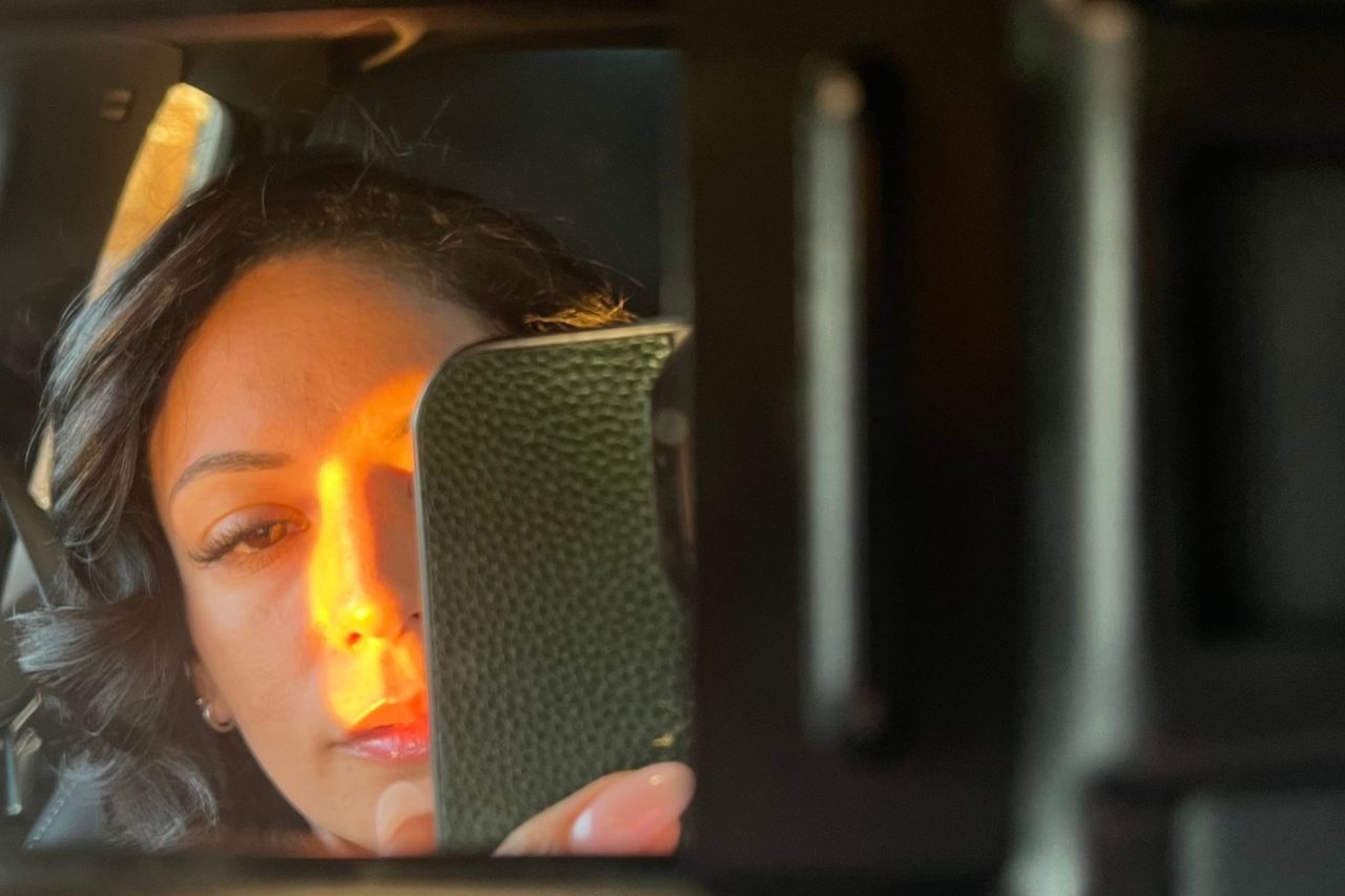 My Experience Getting a Skin Resurfacing Laser Treatment – Total ...